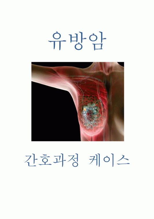 유방암 간호과정 케이스 및 유방암 정의 증상 원인 및 유방암 예방과 치료법 연구