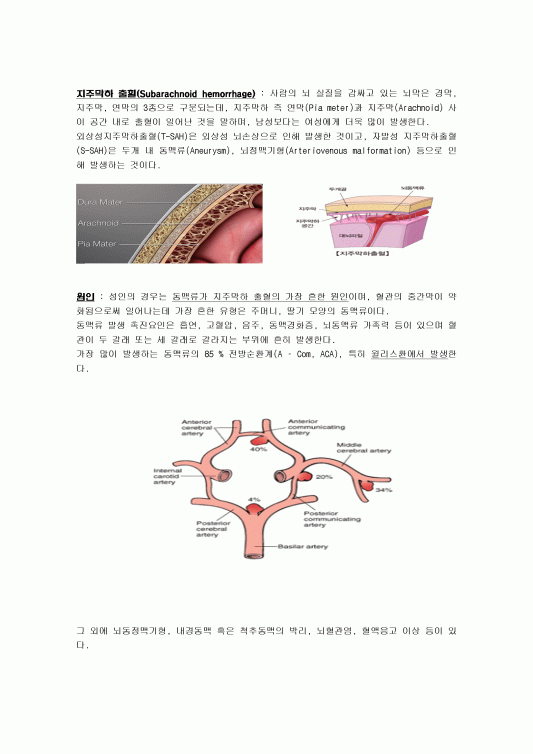 신규간호사도 이해할 수 있게 만든 지주막하출혈 자료(시술 및 이미지)