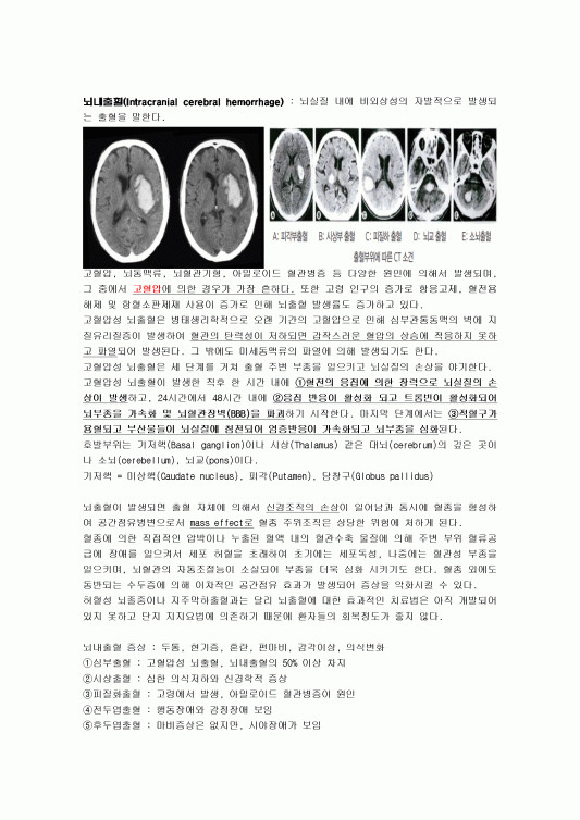 신규간호사도 이해할 수 있게 만든 뇌내출혈 및 두개내압 공부