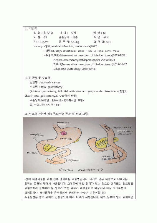 수술실 보고서. stomach cancer , total gastrectomy, 성인간호실습