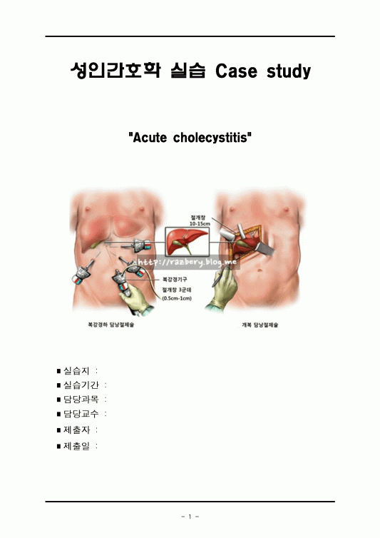 Acute cholecystitis Case study (이미지 포함), 간호진단,과정 각각 2개씩