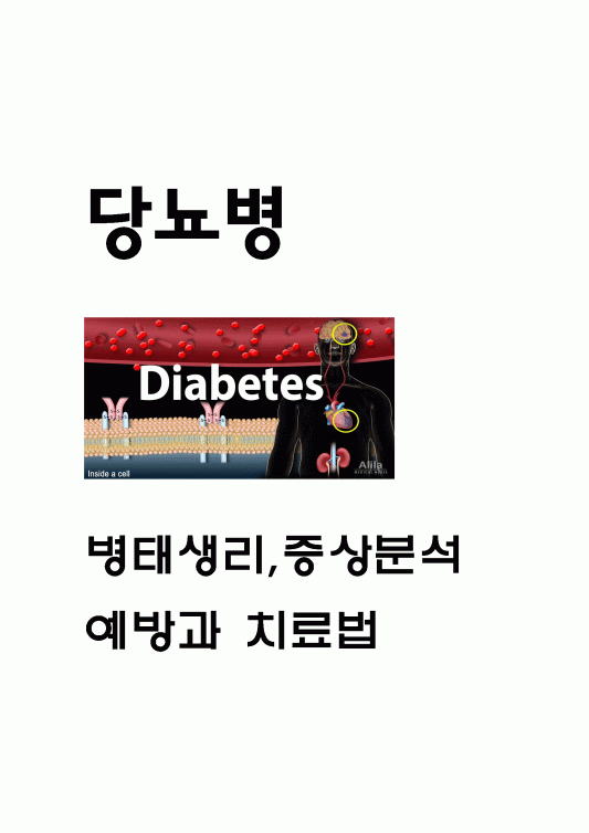 당뇨 병태생리,증상분석 및 당뇨 합병증과 당뇨 예방과 치료법 연구