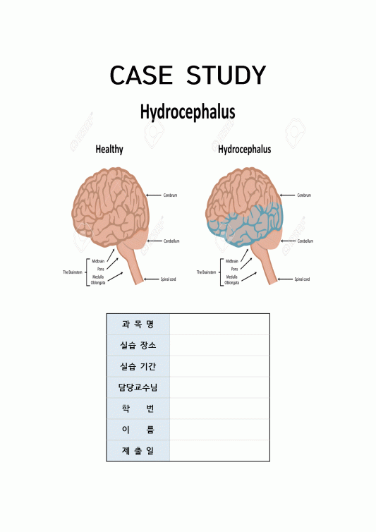 신경외과 간호과정 (학술제 발표자료, 간호진단, 과정 2가지 상세기술)