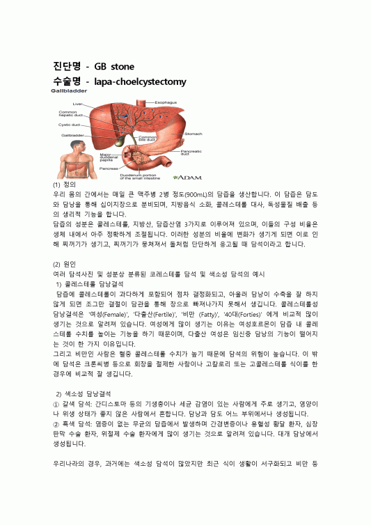 진단명-GB stone(담석), 수술명 - lapa-cholecystectomy(복강경식 담낭적출술)