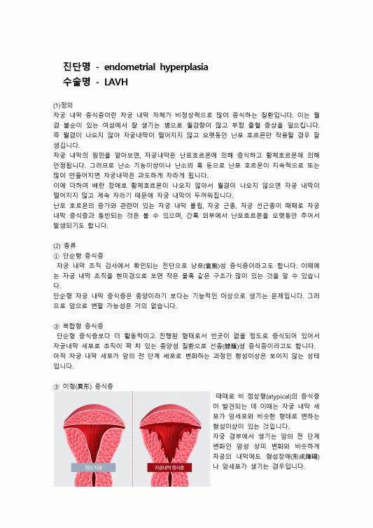 진단명 - endometrial hyperplasia (자궁 내막 증식증), 수술명 - LAVH (복강경식 질식 자궁절제술)