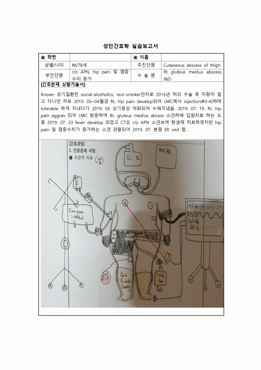 성인 간호학 실습 케이스 스터디 - abscess, APN