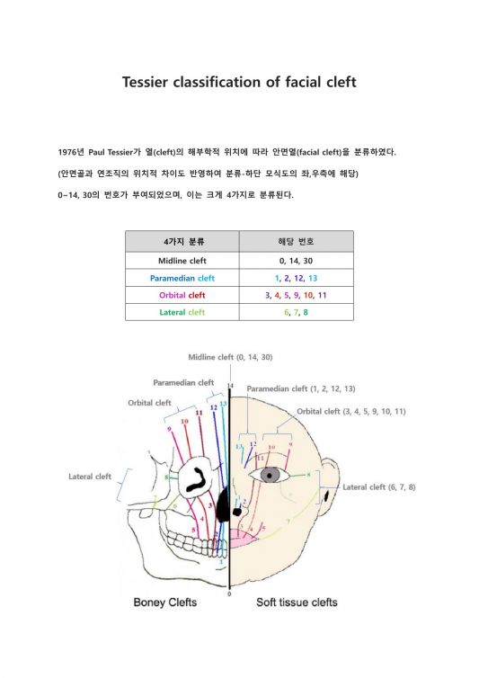 구강외과 레포트(Tessier 분류)