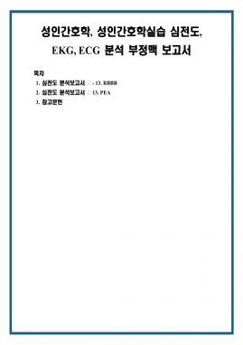 성인간호학, 성인간호학실습 심전도, EKG, ECG 분석 부정맥 보고서